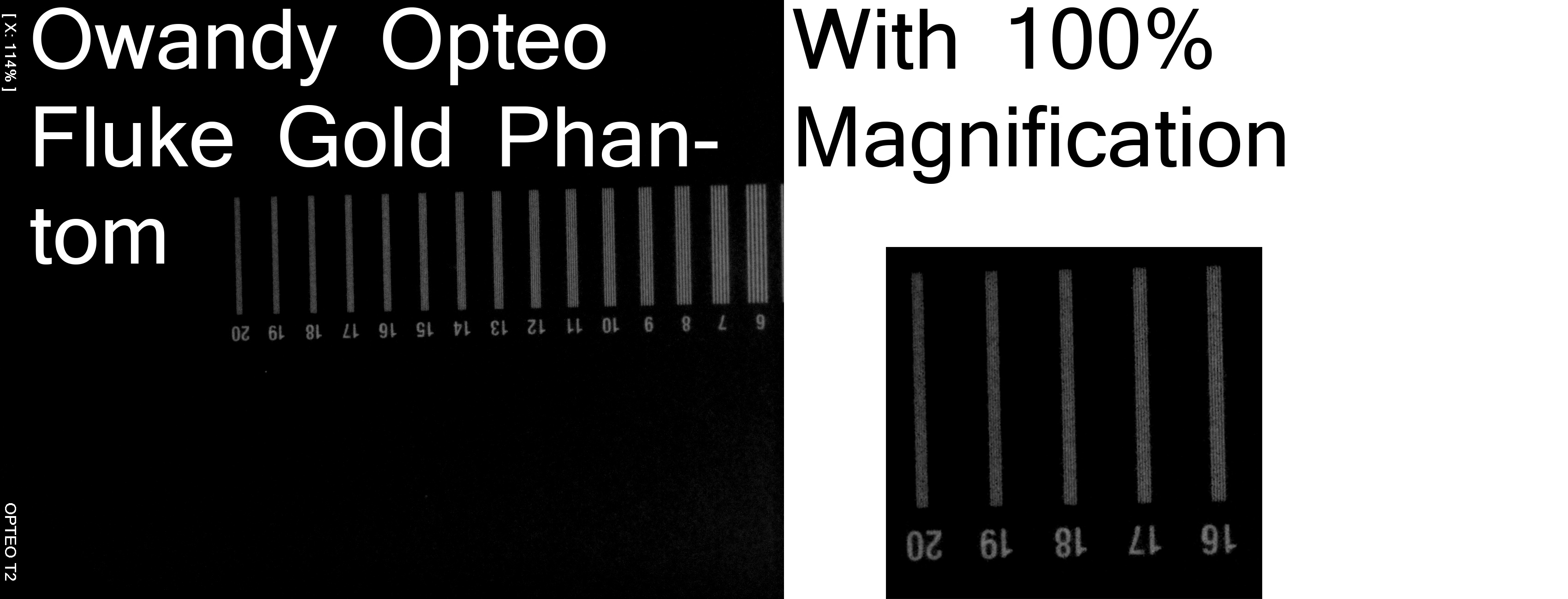 Line Pairs Per Millimeter Phantom Test Platinum, Uniray, Owandy Opteo