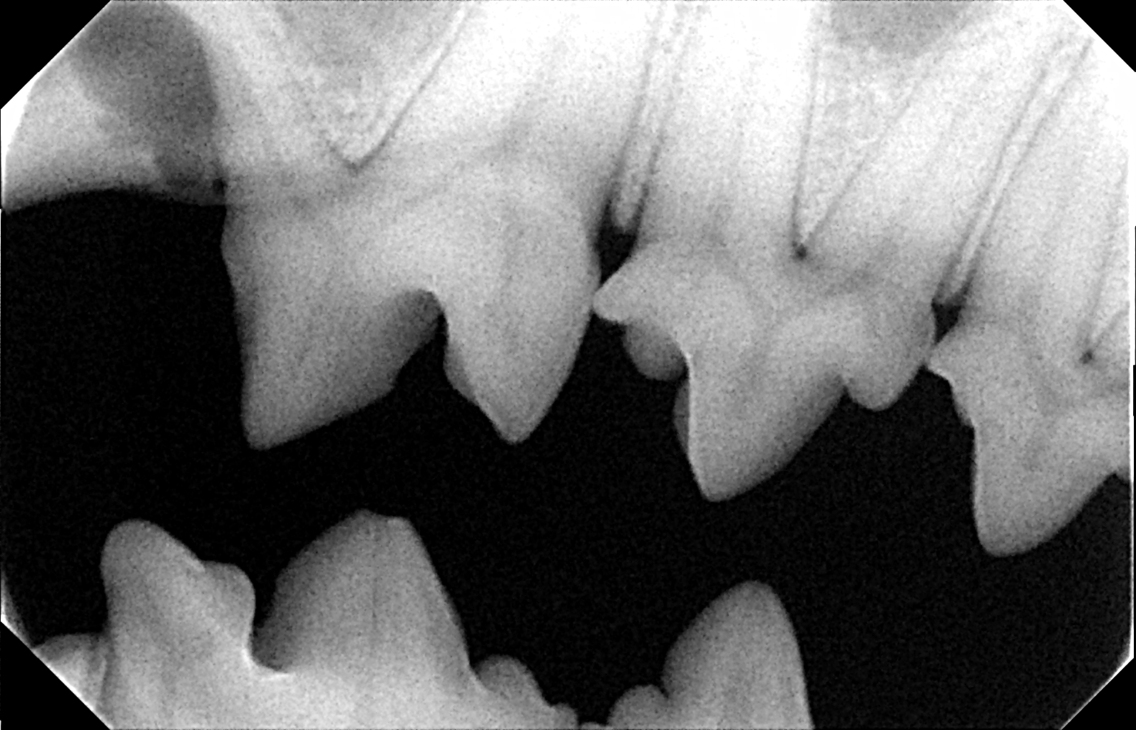 Used Gendex VISUALIX EHD, size 1-Xray Repair|Sodium Dental