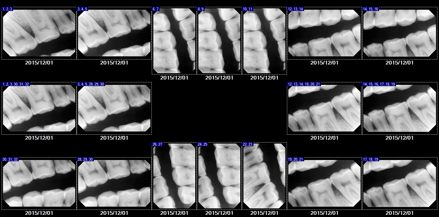 Refurbished Gendex VISUALIX EHD, size 1-Xray Repair|Sodium Dental