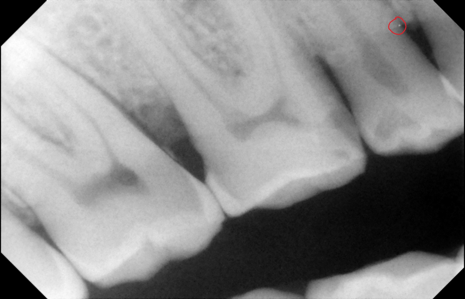 Refurbished Gendex VISUALIX EHD, size 1-Xray Repair|Sodium Dental