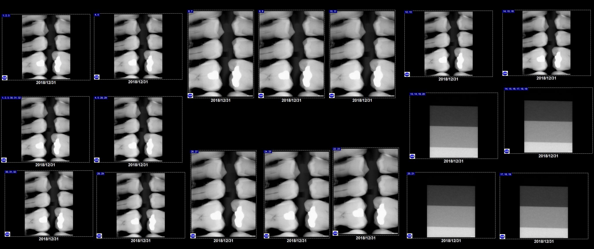 Refurbished Kodak RVG 6100 Size 2-Sodium Dental