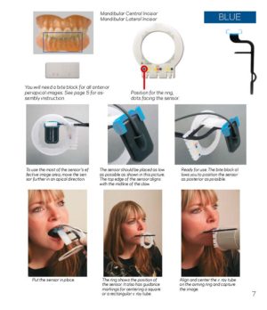 Trollbyte Sensor Holder Kimera Kit