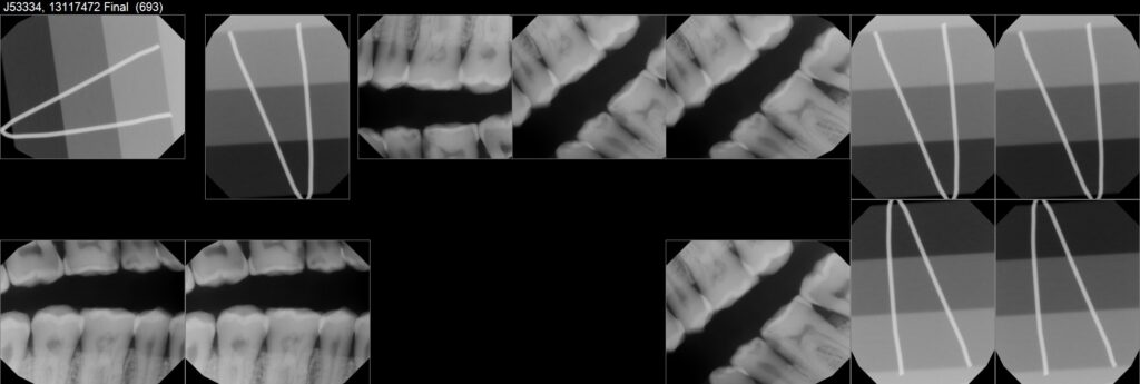 Grade A Dexis Titanium Sensor